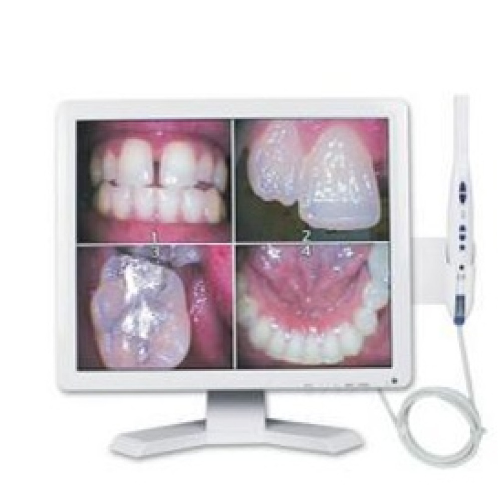 INTRAORAL CAMERA WITH MONITOR