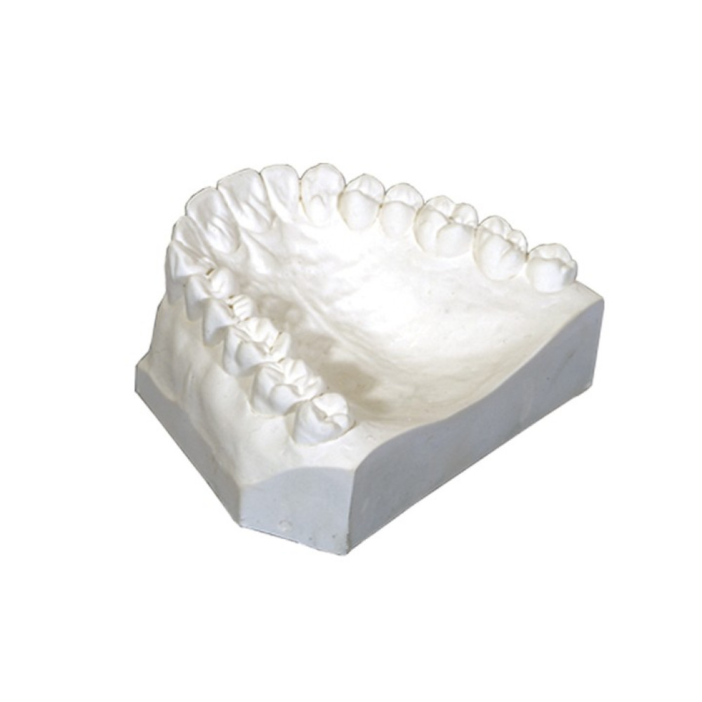 Ultra-White Ortho Plaster (50LB) – High-Precision Dental Plaster in ...